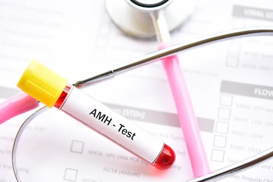 What Is the AMH Test and Why Is It Crucial for Women Over 30?