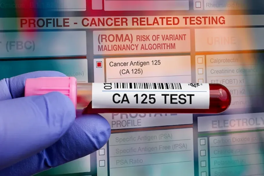 CA-125 Normal Range In Women Explained