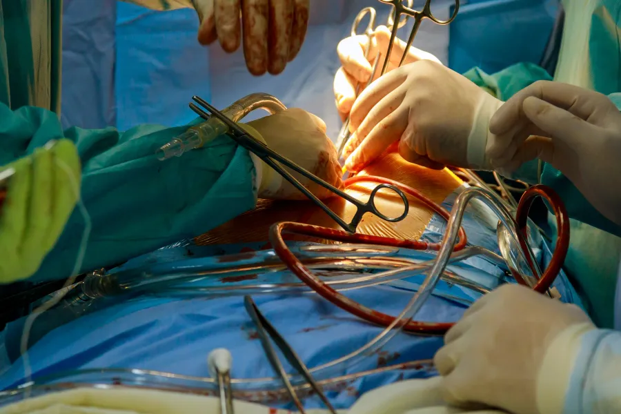 Driving After Heart Bypass Surgery