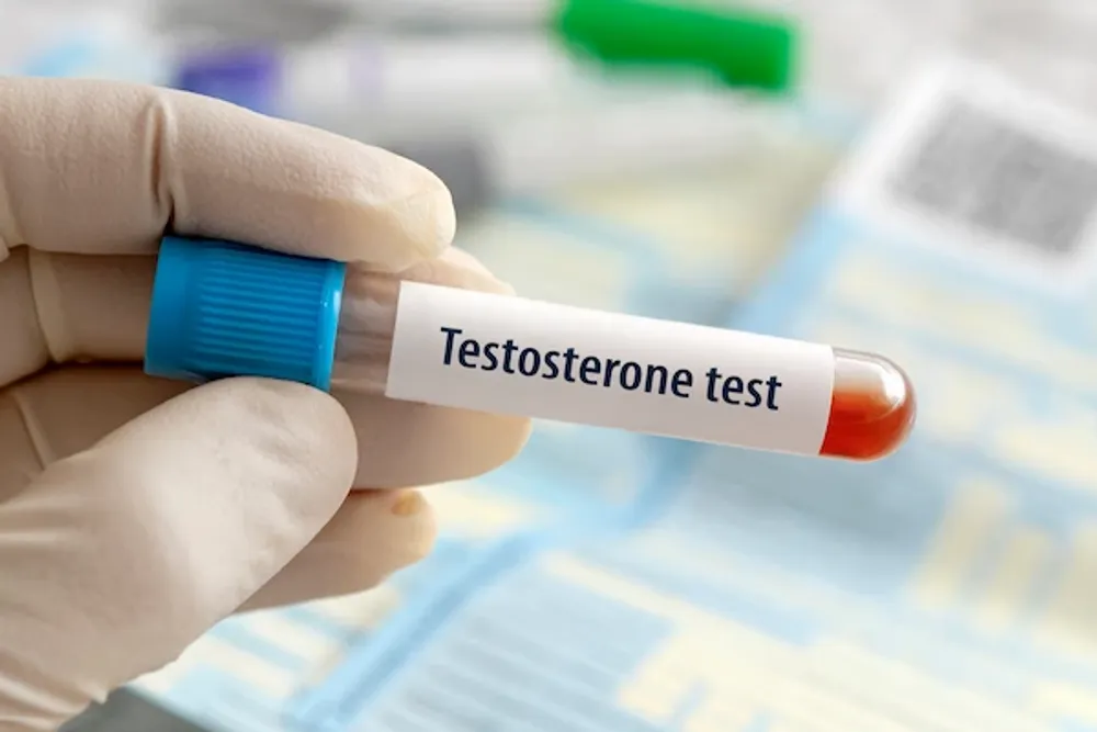testosterone test