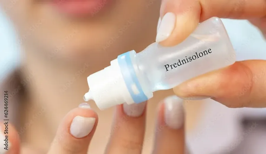 Prednisolone Eye Drops Before Cataract Surgery: Know What Is The Use
