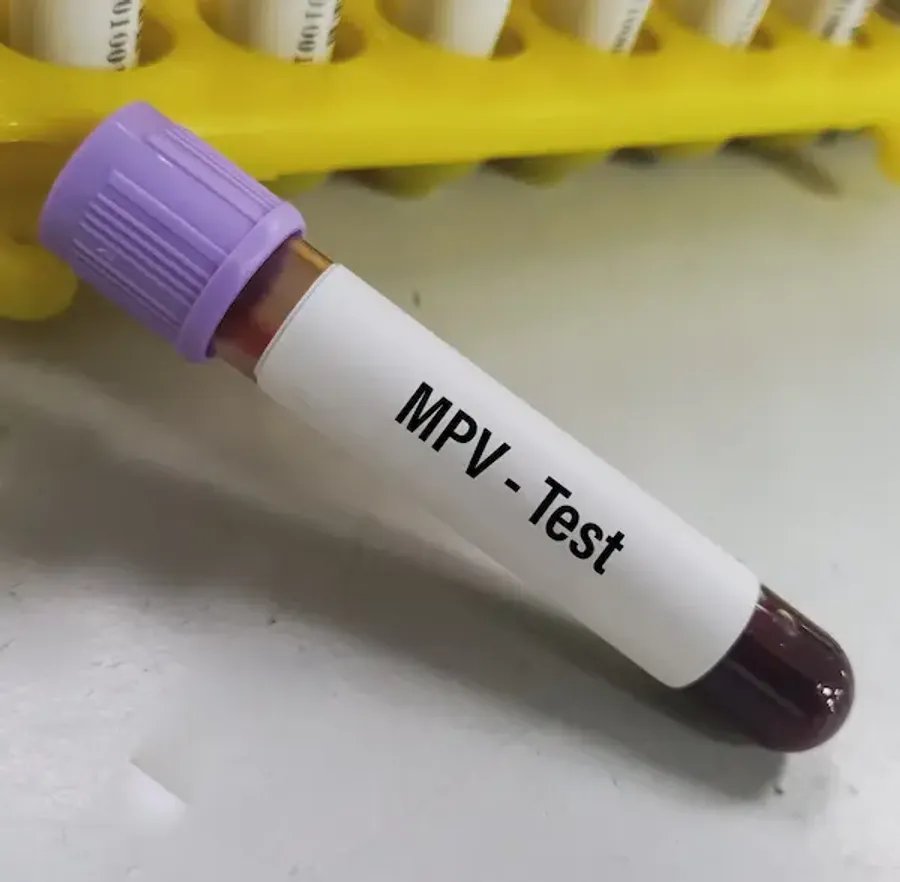Normal Range for MCV Blood Test