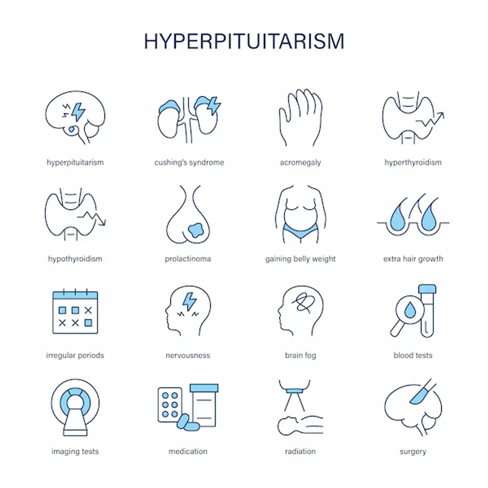 hyperpituitarism causes