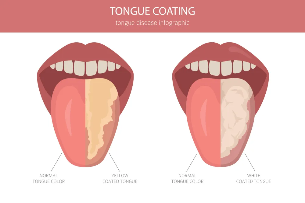 normal tongue under