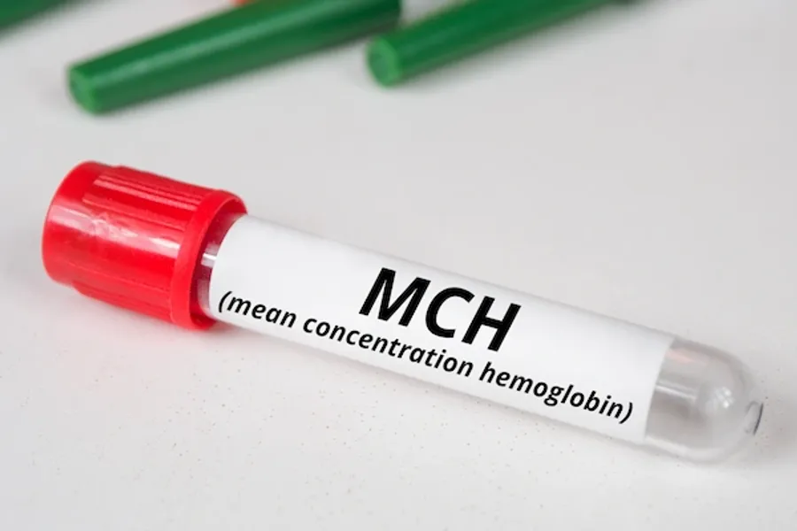 MCH Blood Test and Its Reference Ranges