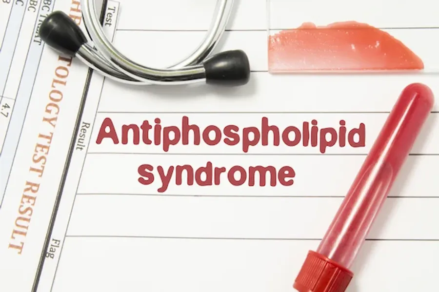 Antiphospholipid Syndrome: Overview