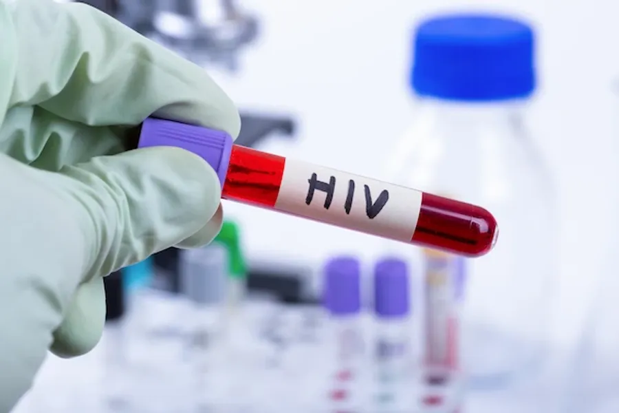 ELISA Test for HIV: Overview and Process