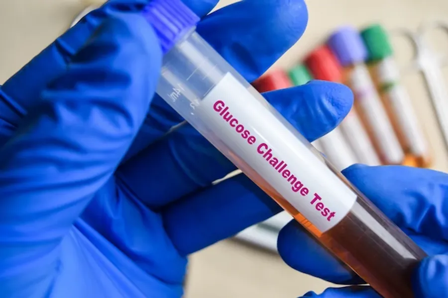 GCT Test Normal Range Explained