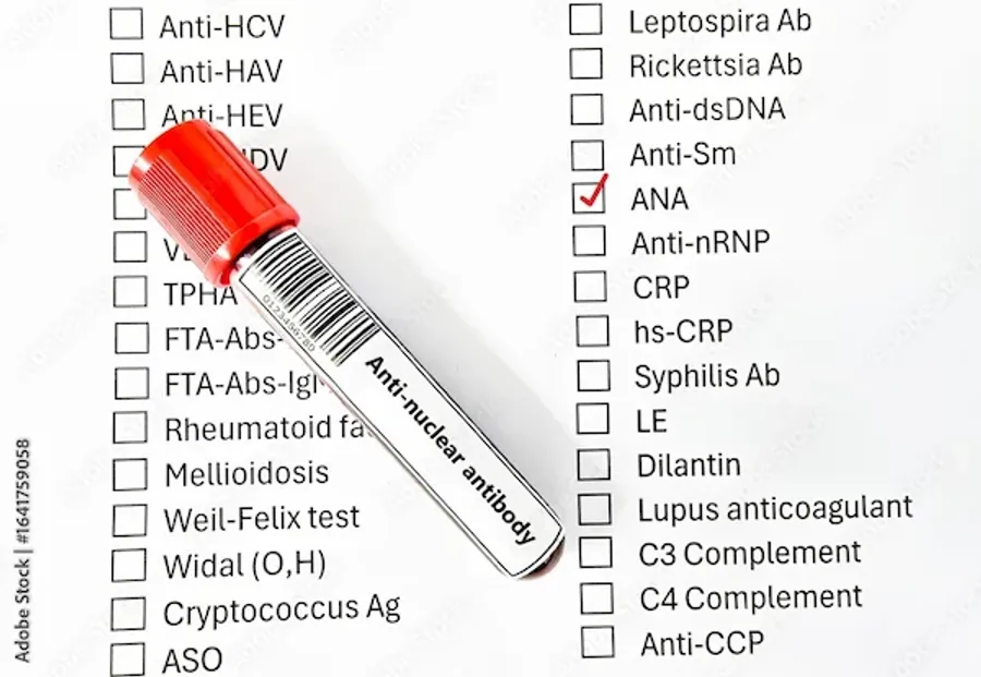 ANA Test Procedure and Results