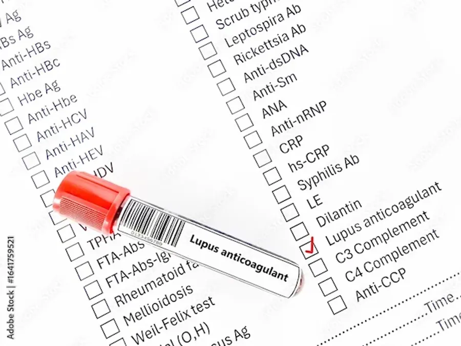 Understanding the Lupus Anticoagulant Test