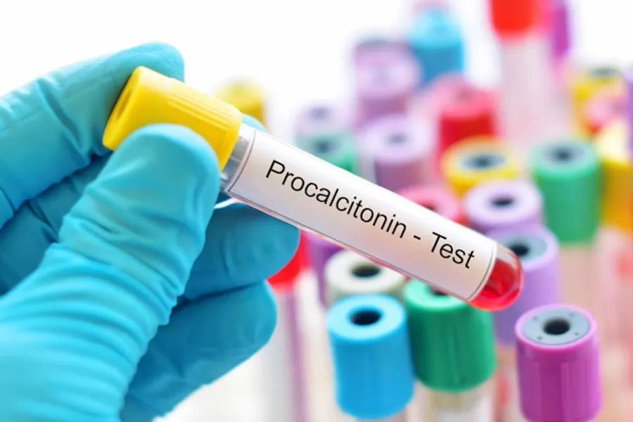 Procalcitonin Blood Test Overview and Interpretation