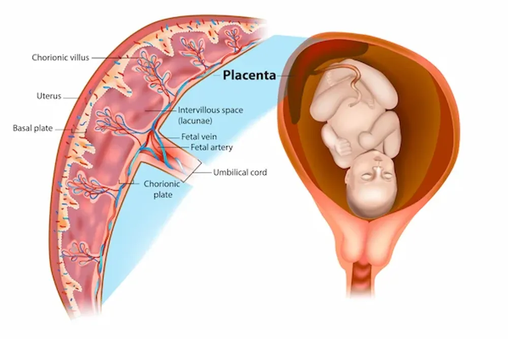placenta previa causes