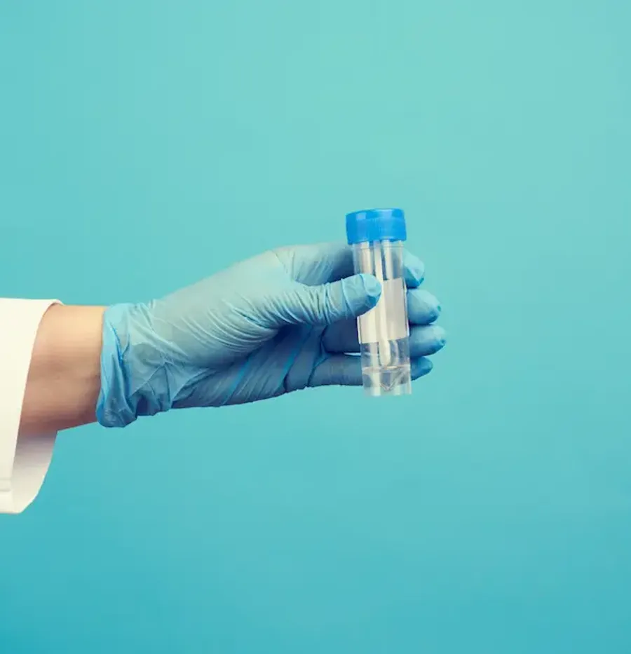 Stool Tests and Their Significance