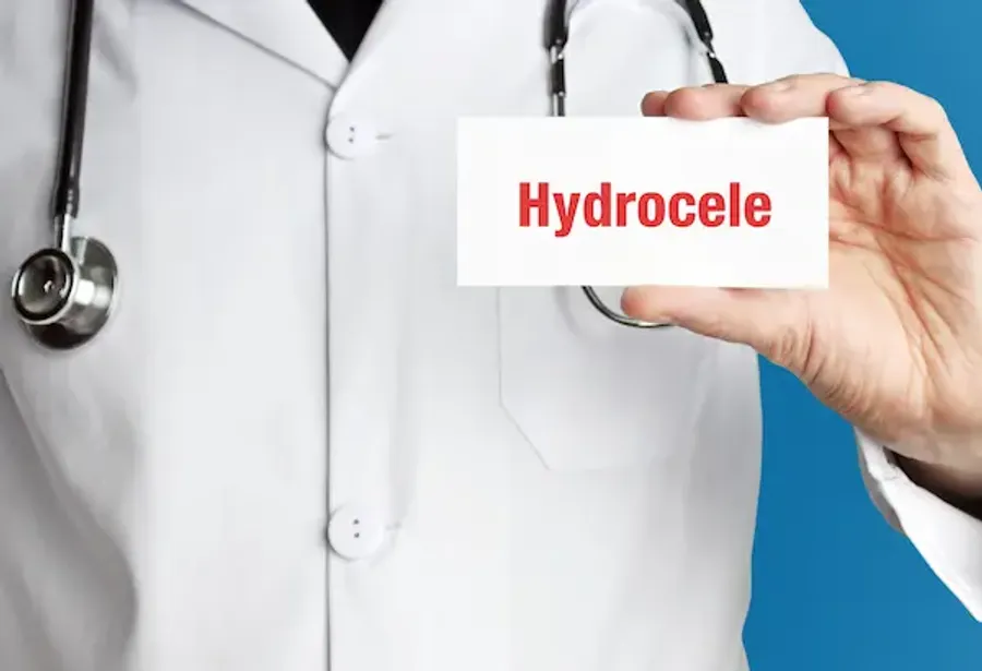 Hydrocele Overview: Symptoms, Causes, and Treatment