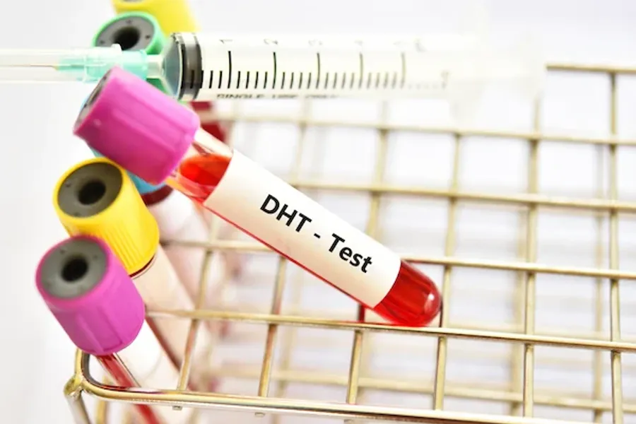 Understanding DHT: The Hormone Behind Hair Loss and More