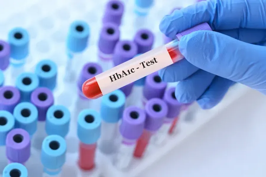 Understanding the Haemoglobin A1C Test