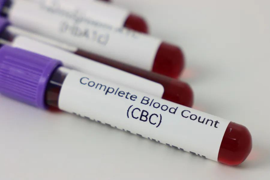 Blood Test Abbreviations Explained