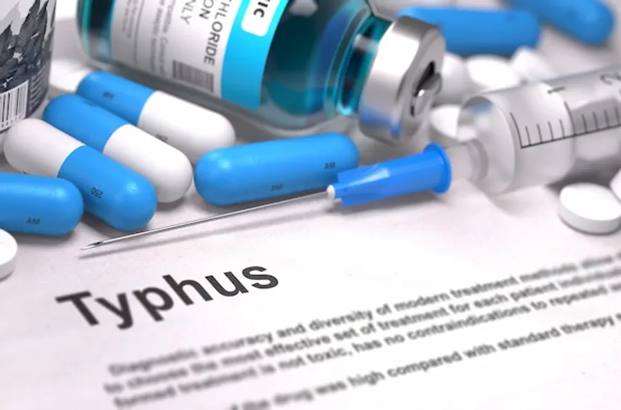 Typhus Fever Overview and Prevention