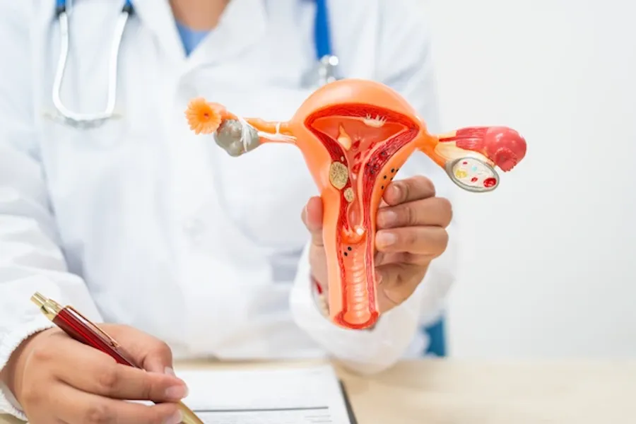 Causes of Cervical Cancer Explained