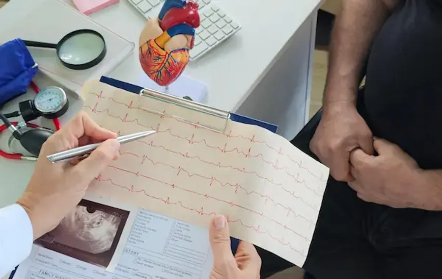 Understanding the ECG Test and Its Procedure