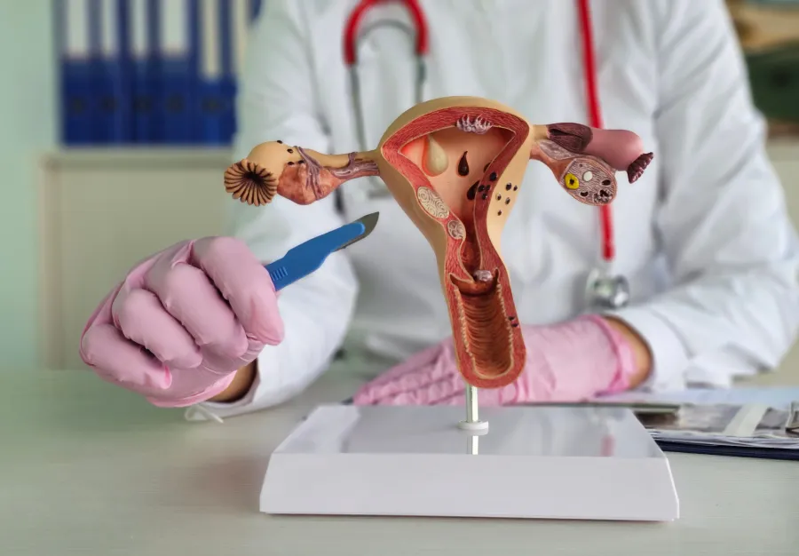 Best Sitting Position After Hysterectomy