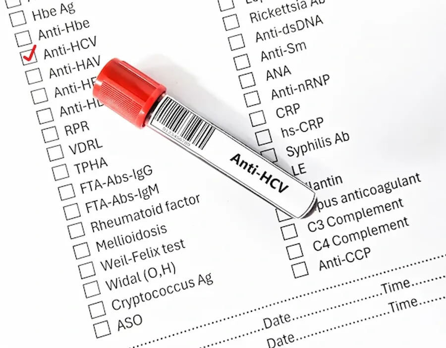 Guide to Anti Hcv Test Normal Range