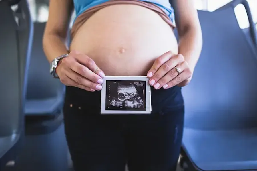 Your Guide to Endobronchial Ultrasound (EBUS): A Minimally Invasive ...