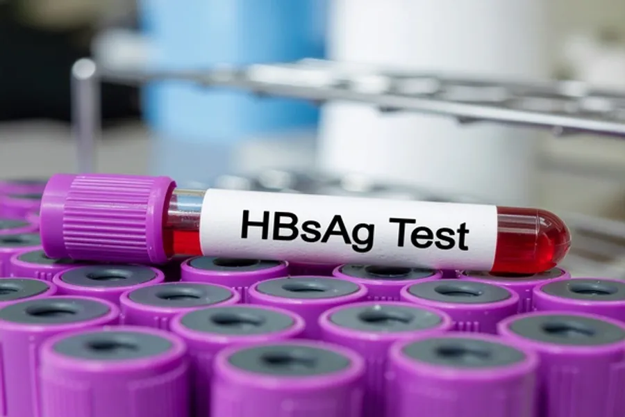 Purpose and Procedure of HBsAg Testing