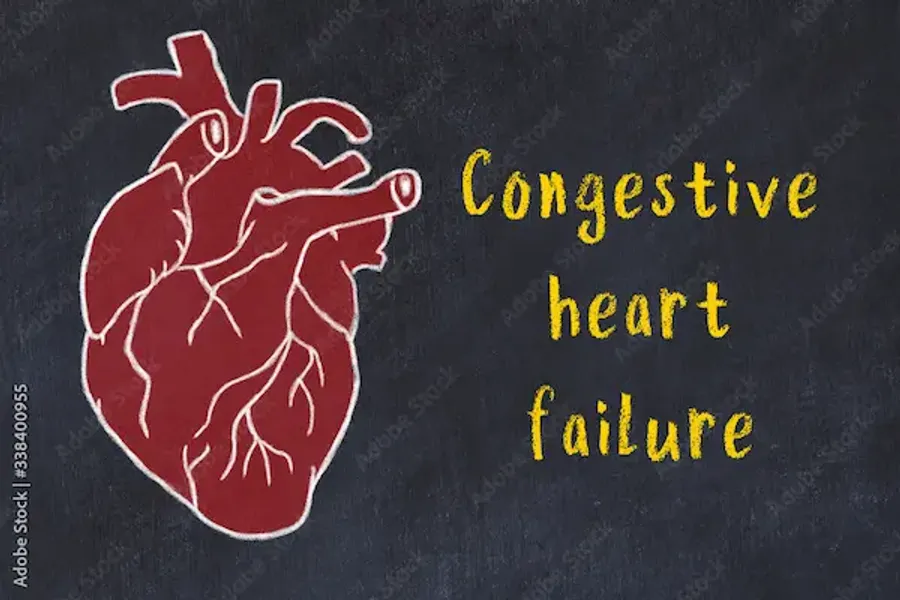 Signs Of Do You Know The Warning Signs And Signs And Of Congestive ...