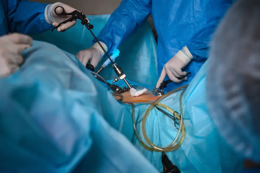 How Do They Remove Uterus During Laparoscopic Hysterectomy?