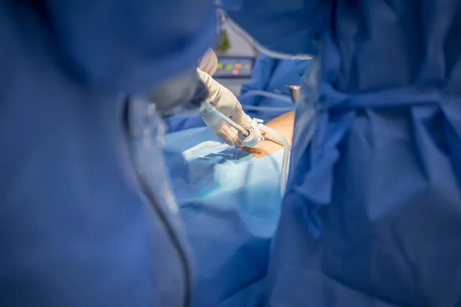Laparoscopic Surgery: A Complete Guide to Minimally Invasive Procedures