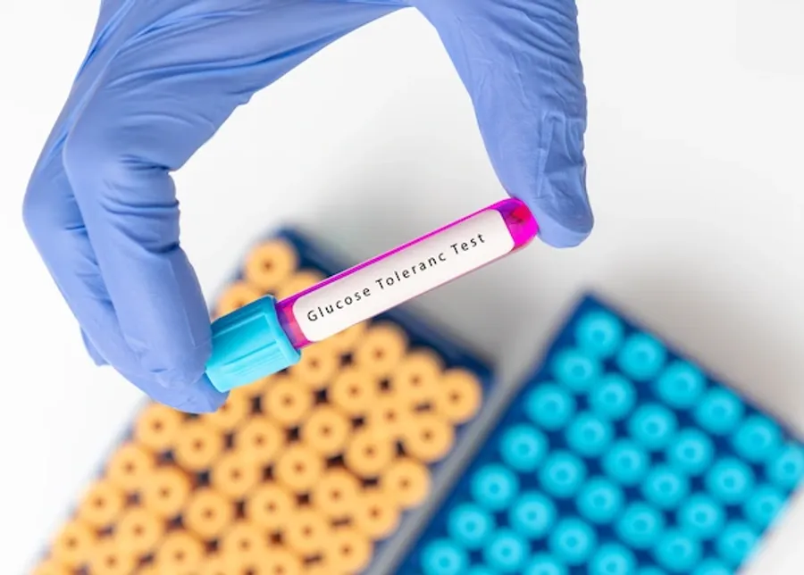 Glucose Tolerance Test: Understanding Normal Range