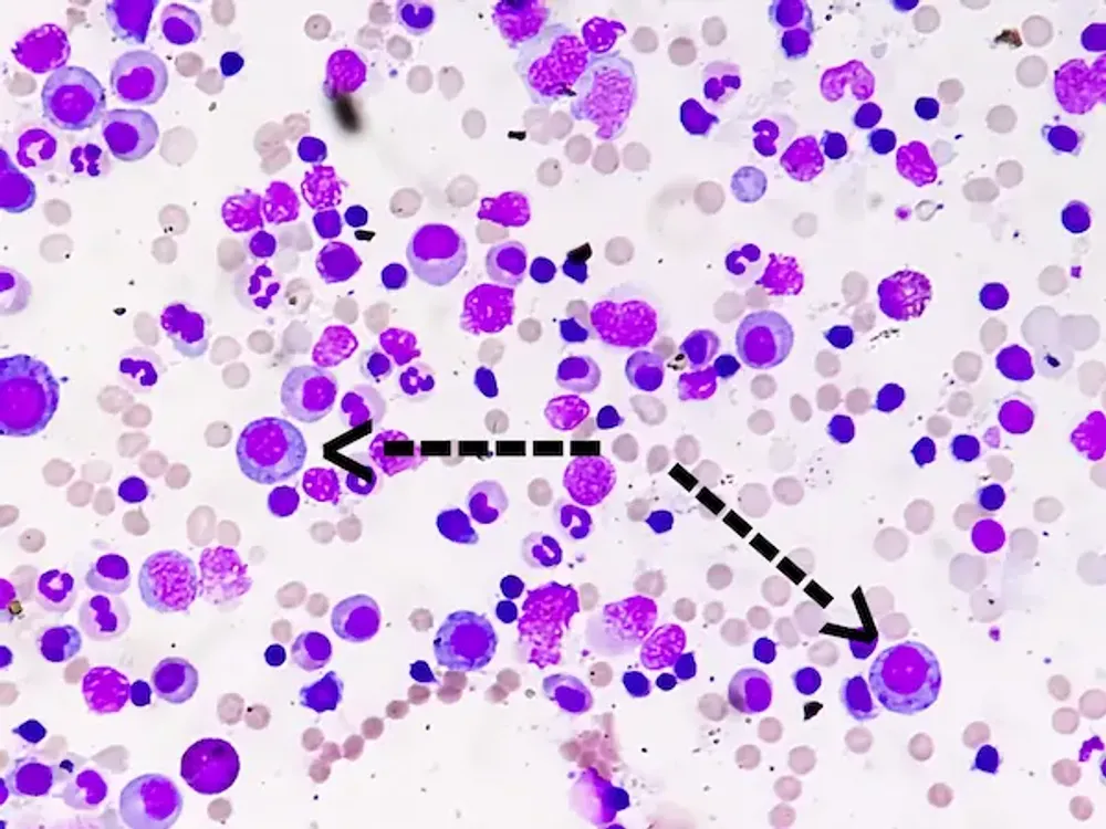 immune system attacks connective tissue