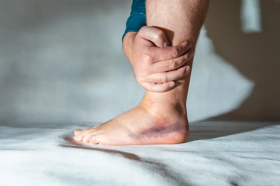 Sprained Ankle Signs: From First Twinge to Full Recovery