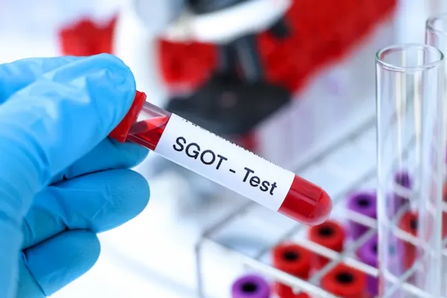 Guide to SGOT Test And Normal Range