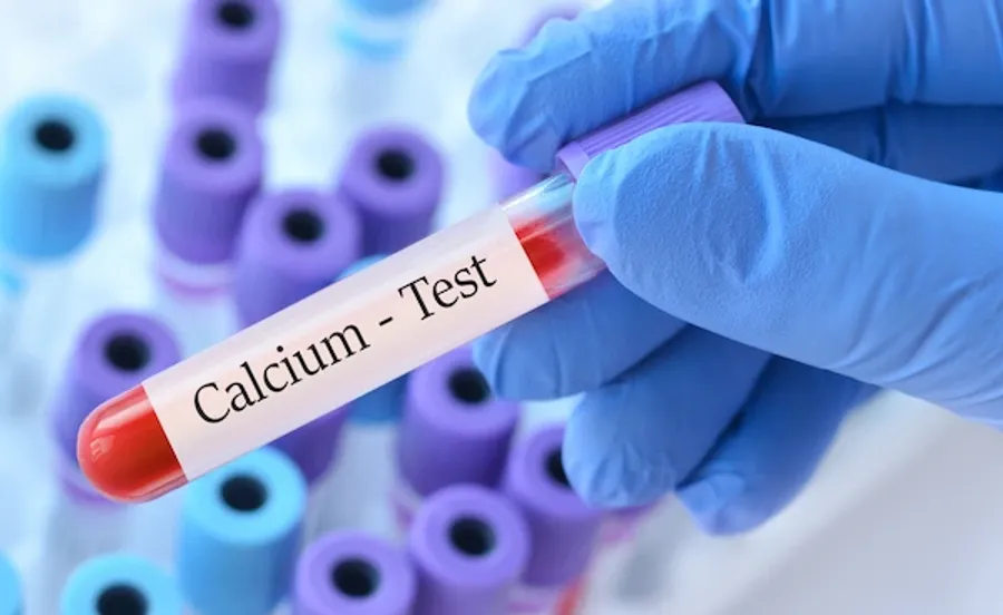 Calcium Blood Test and Normal Range