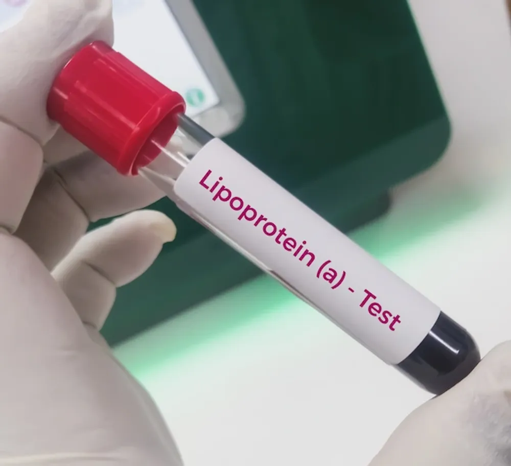 lipoprotein a test