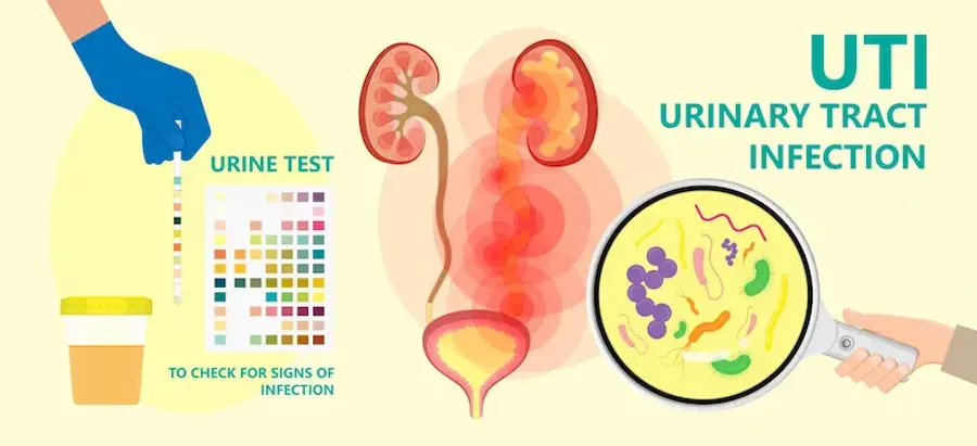 CAKUT Explained Kidney and Urinary Tract Birth Defects