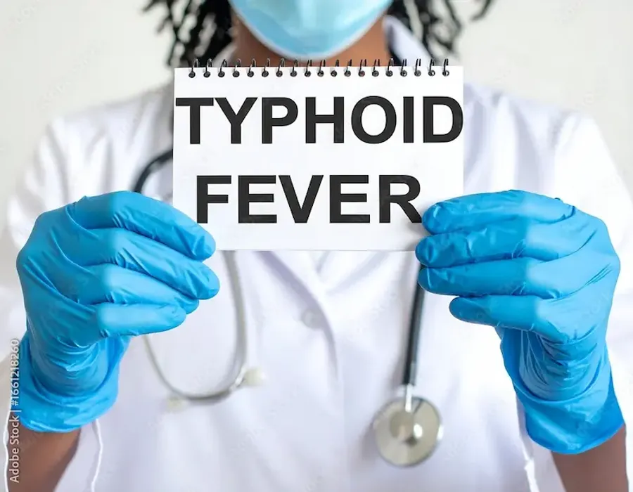 Early Signs of Typhoid Fever Don't Ignore These Symptoms