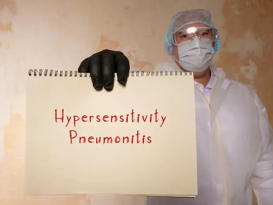 Hypersensitivity Pneumonitis Overview and Management