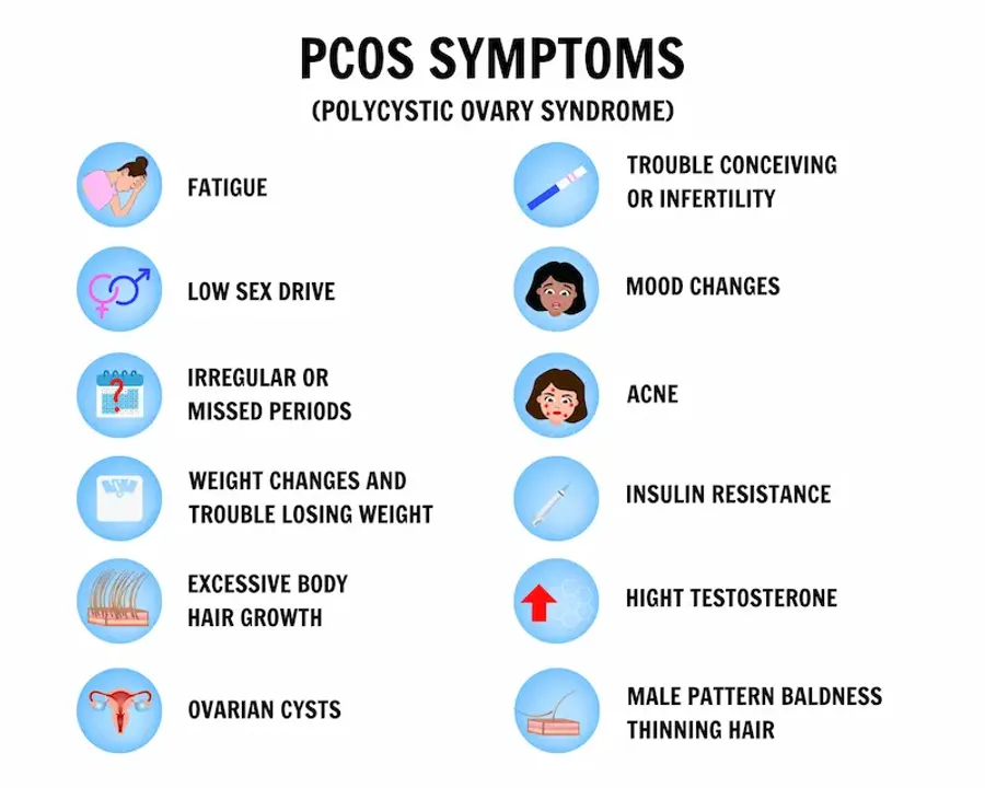 PCOS and Infertility A Guide for Successful Conception