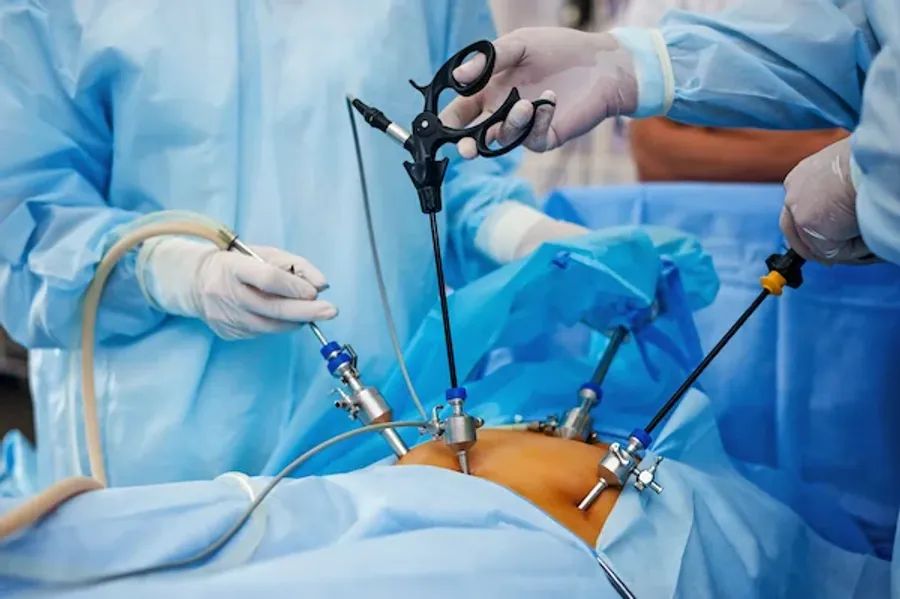 The Evolution of Keyhole Surgery: From Keyhole to Pin-Hole Laparoscopic ...