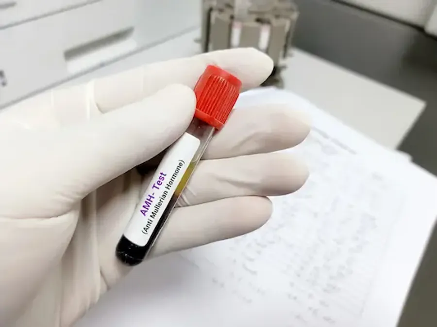 AMH Test: Full Form and Explanation