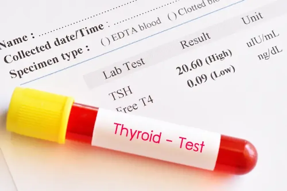 thyroid lab normal ranges