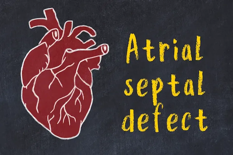 Adult Atrial Septal Defect and Life Expectancy