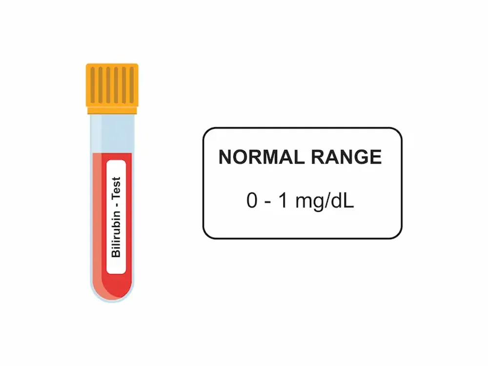 normal bili levels uk