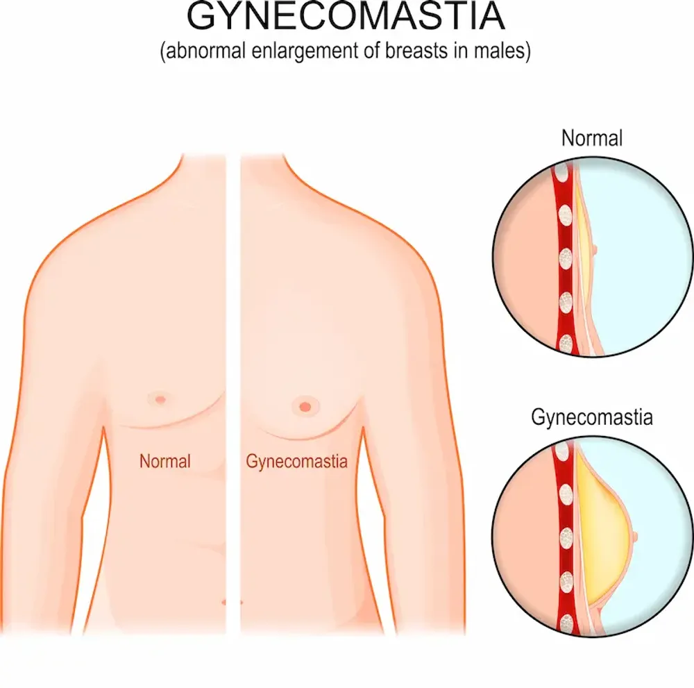 breasts during puberty
