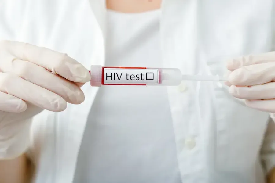 HIV Urine Symptoms You Should Know