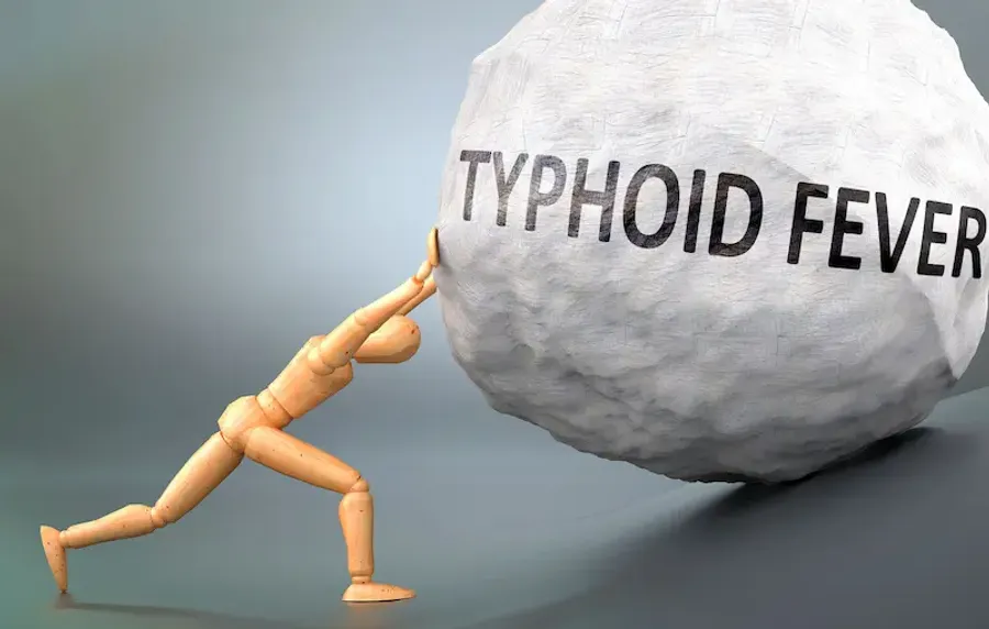 Understanding the Stages of Typhoid Fever
