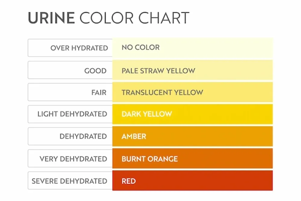 urine color chart disease